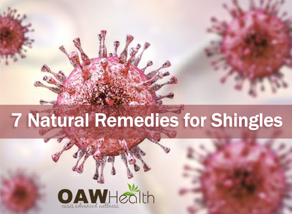 7 Natural Remedies for Shingles