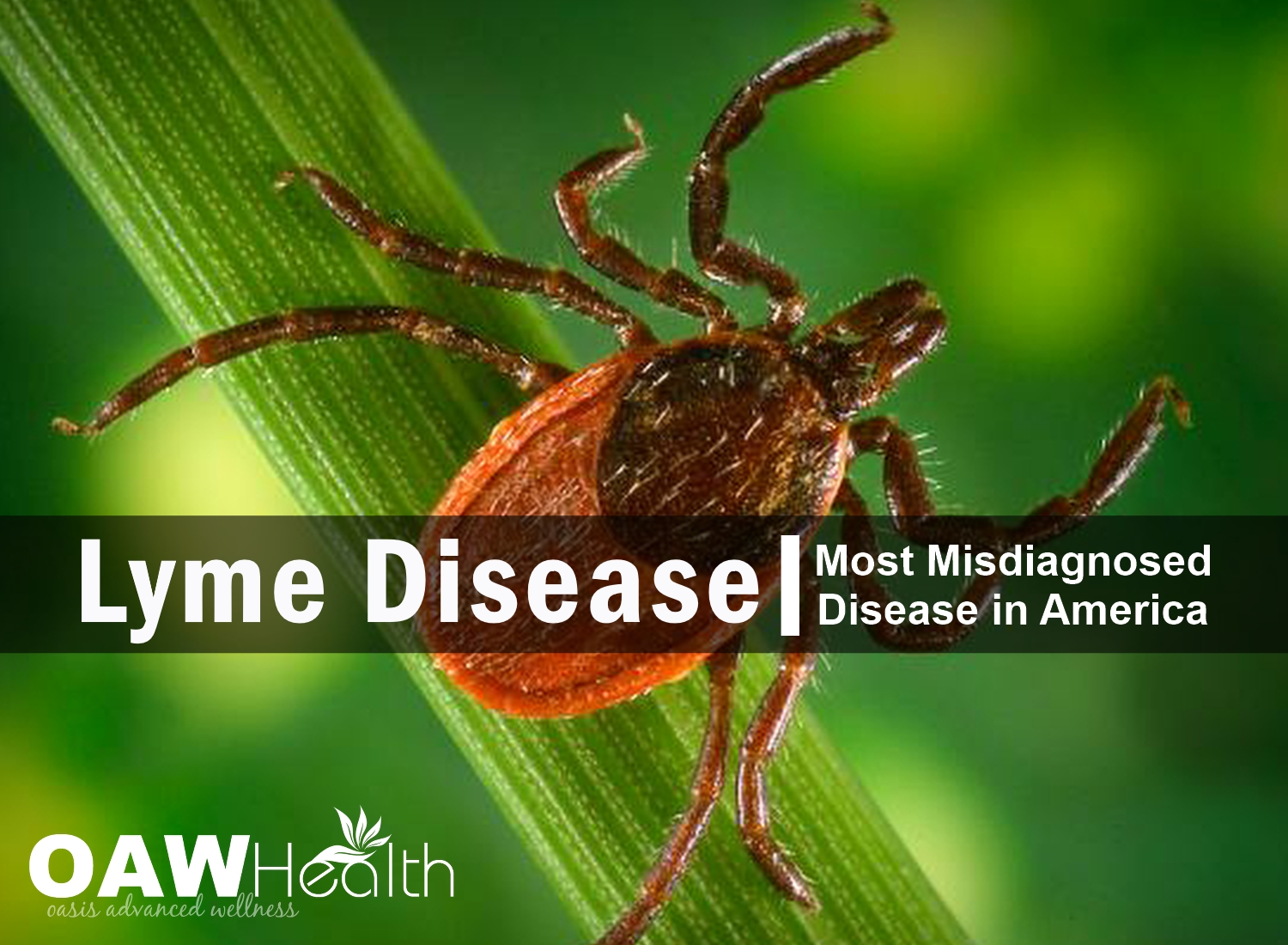 Lyme Disease - Most Misdiagnosed Disease in America
